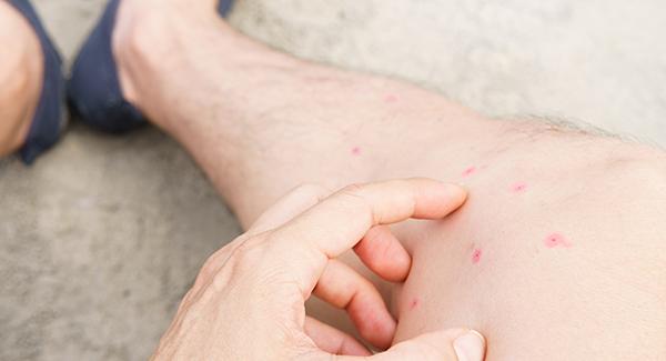 How To Tell If Fleas Are In Your South Portland Home